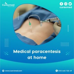 What is the Medical Paracentesis at Home Service? | curexmed